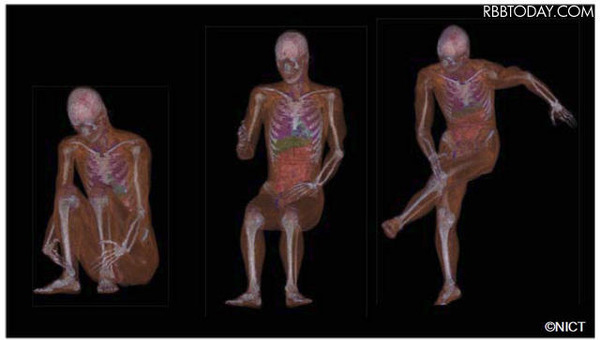 「数値人体モデル用ソフト」公開、電波との相互影響をシミュレート（NICT） | ScanNetSecurity